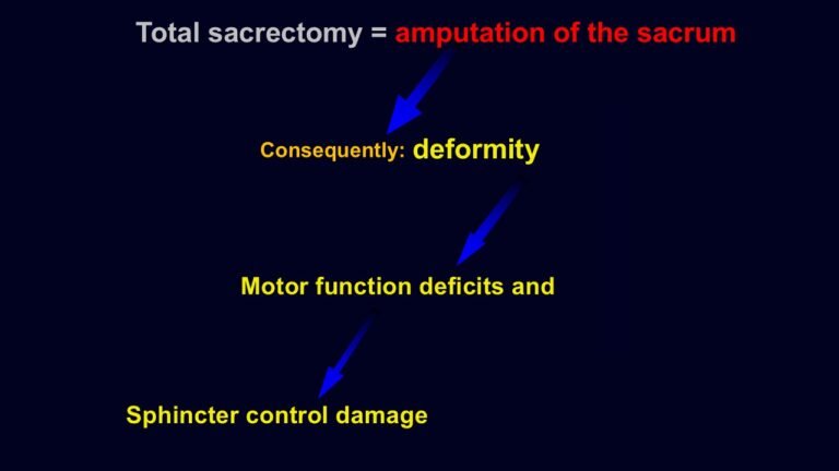 Total sacrectomy without reconstruction - Part I - Oncosurgery