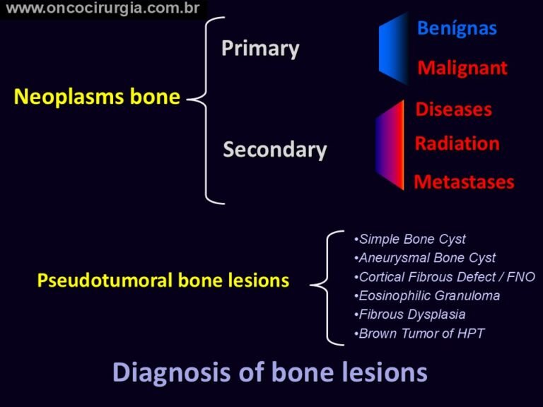 Diagnosis of bone lesions - Oncosurgery