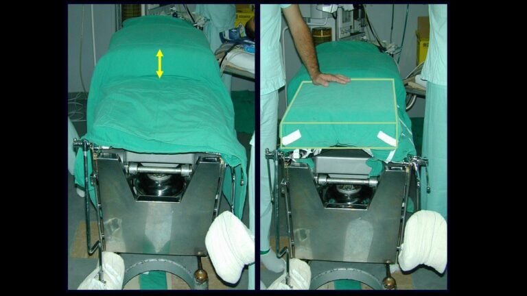 Total sacrectomy without reconstruction - Part I - Oncosurgery